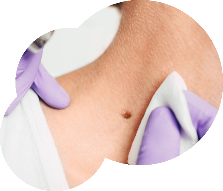 Alaska Family Dermatology - Alaska's Top Dermatology Clinic